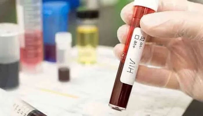 Ministry sets aside fine on private lab over HIV false report