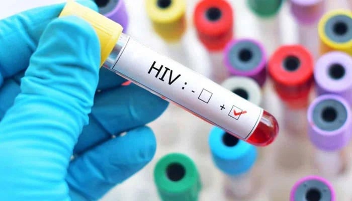 Fight against HIV ‘in peril’ due to aid cuts, UN warns