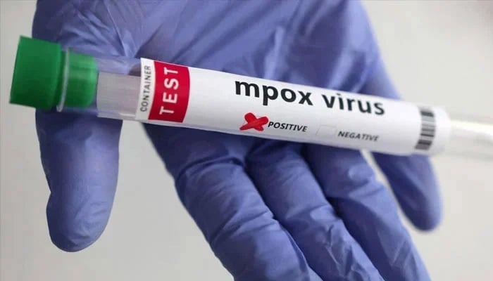 Karachi reports another mpox case as city’s tally rises to 10